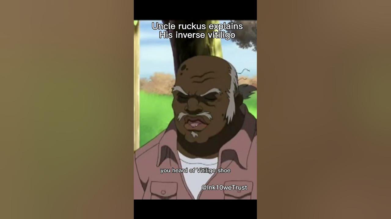 Uncle Ruckus Inverse Vitiligo Explained Boondocks Uncleruckus