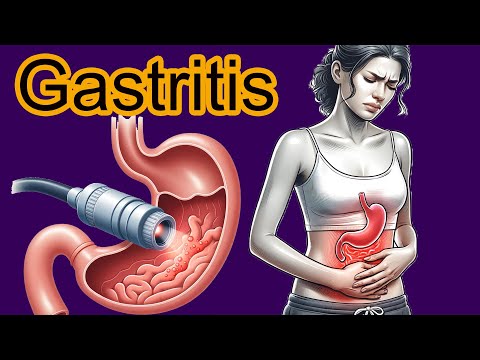 Can Nausea And Voniting Be Sign Oif Gastritis