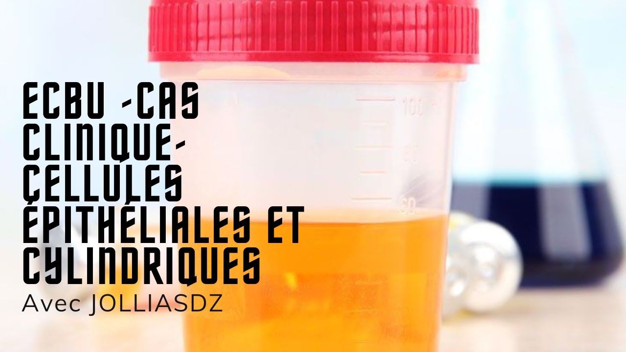 ECBU - Cas clinique- cellules épithéliales et cylindriques - YouTube