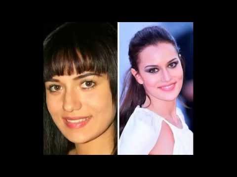 Estetikle başka birine dönüşen Türk Ünlüler Fahriye Evcen, Ebru Salli, Tulin Sahin ve daha da......