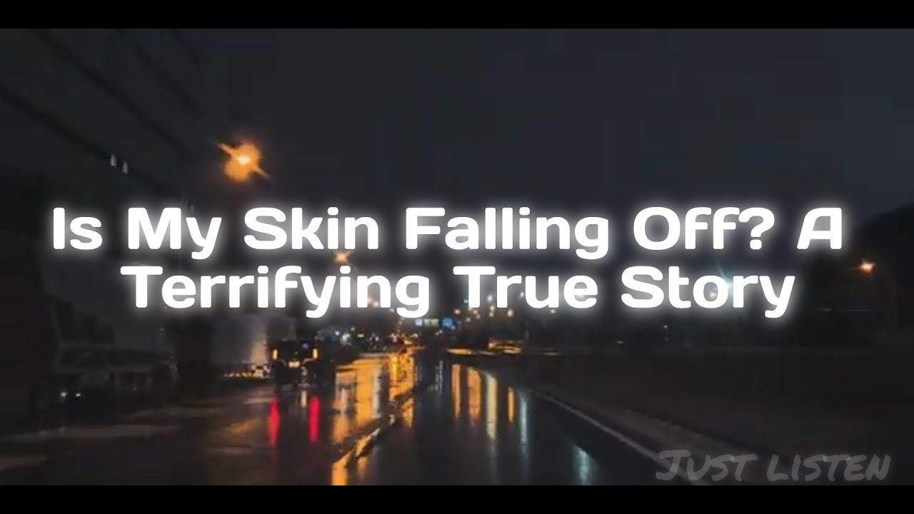Is My Skin Falling Off? A Terrifying True Story - YouTube