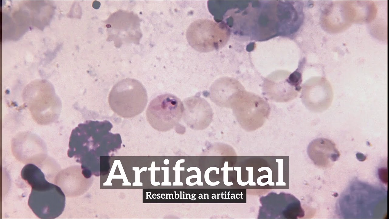 What is Artifactual? | How Does Artifactual Look? | How to Say ...