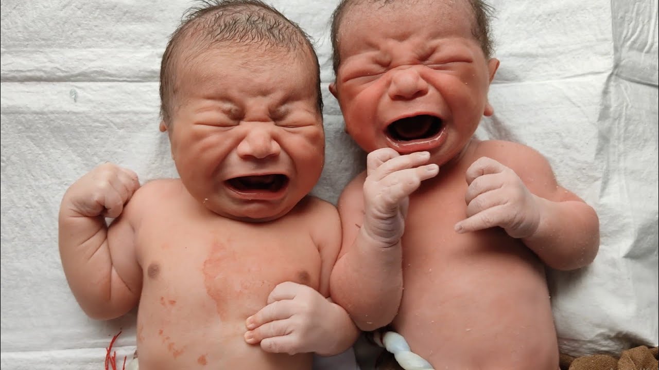 Mother Brought Just one Dress and Got Cute Twin Babies @AfterBirth ...
