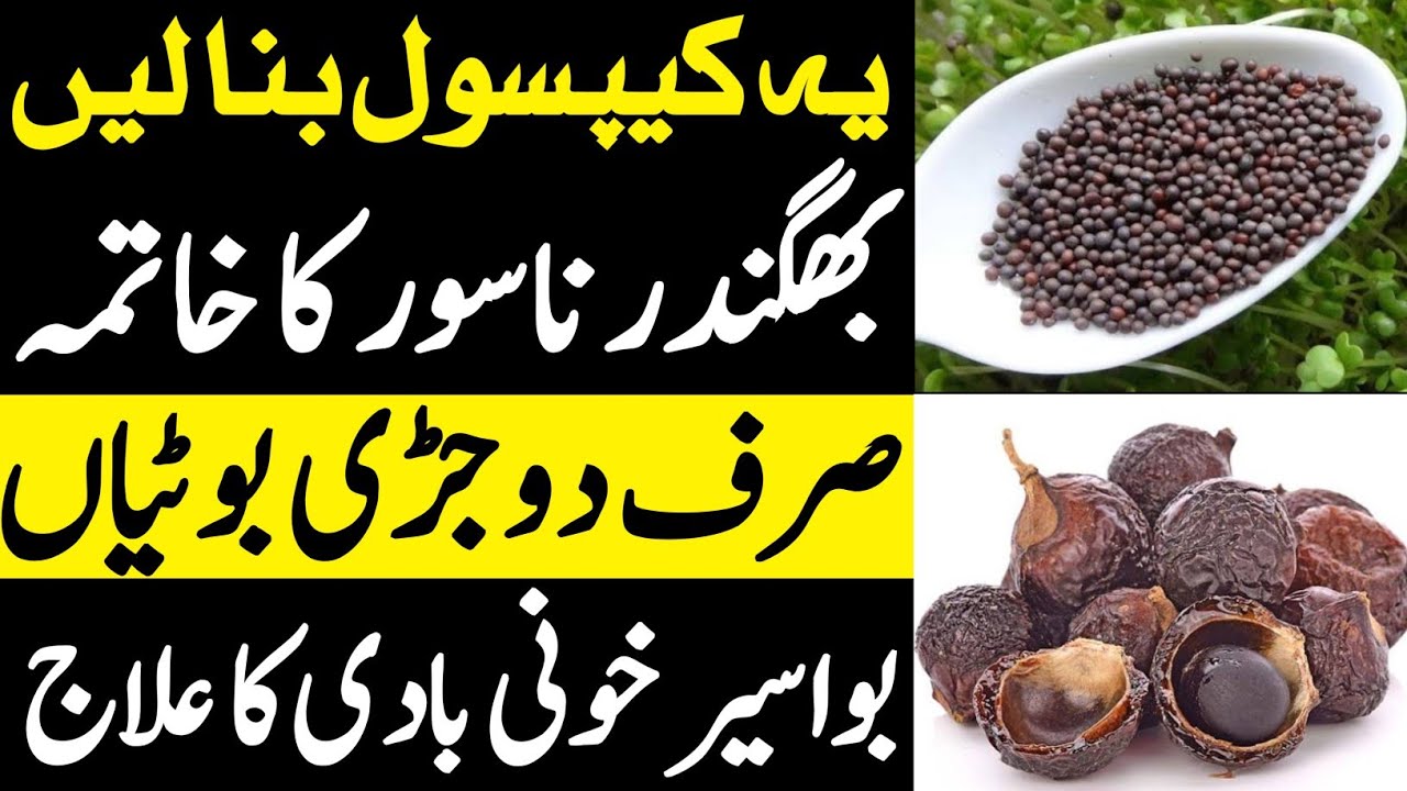 Fistula Treatment || Bhagandar Ka ilaj || Piles Treatment || Bawaseer ...