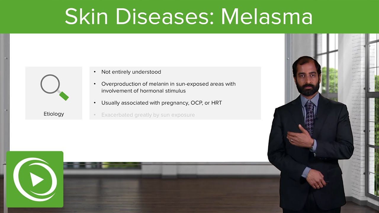 Skin Diseases: Melasma (Chloasma) – Pathology | Lecturio - YouTube