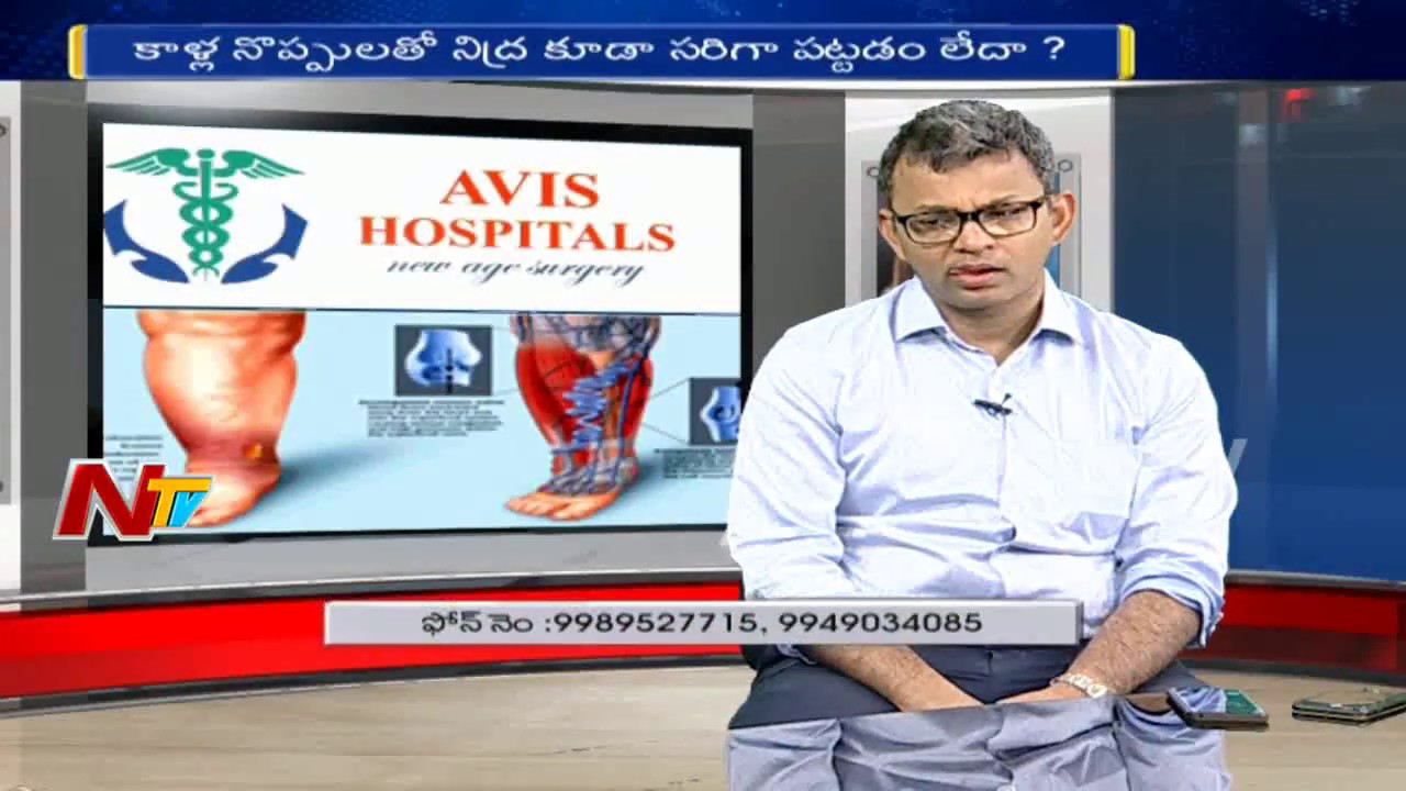 Varicose Veins: Symptoms, Causes & Treatments || Avis Hospitals ...