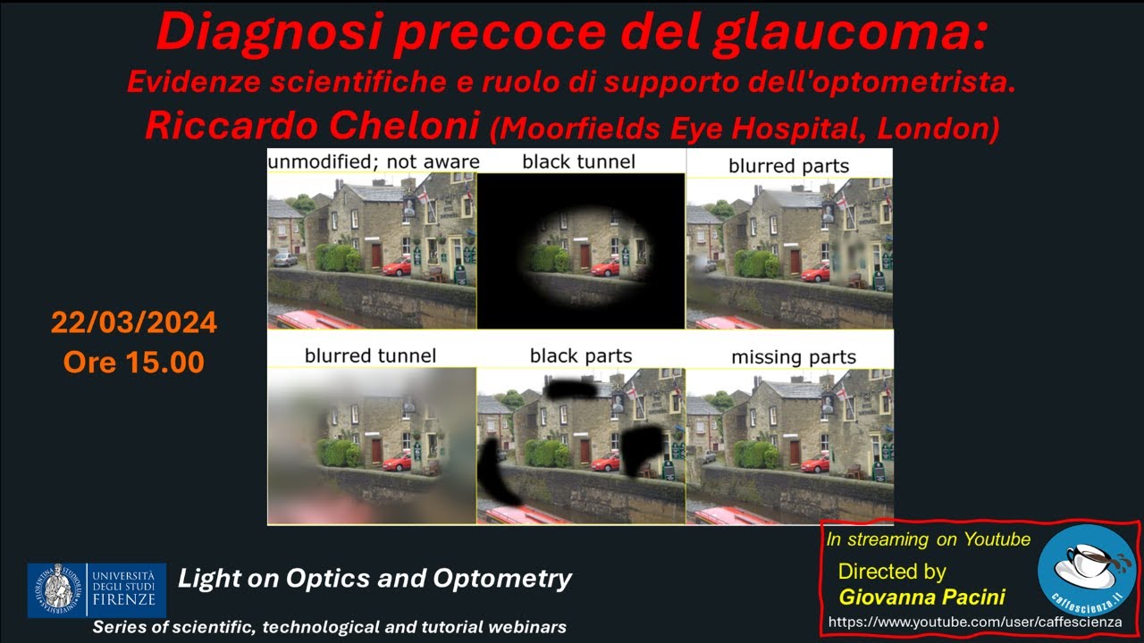 Light in Optics and Optometry – Diagnosi precoce del glaucoma - Diabetes