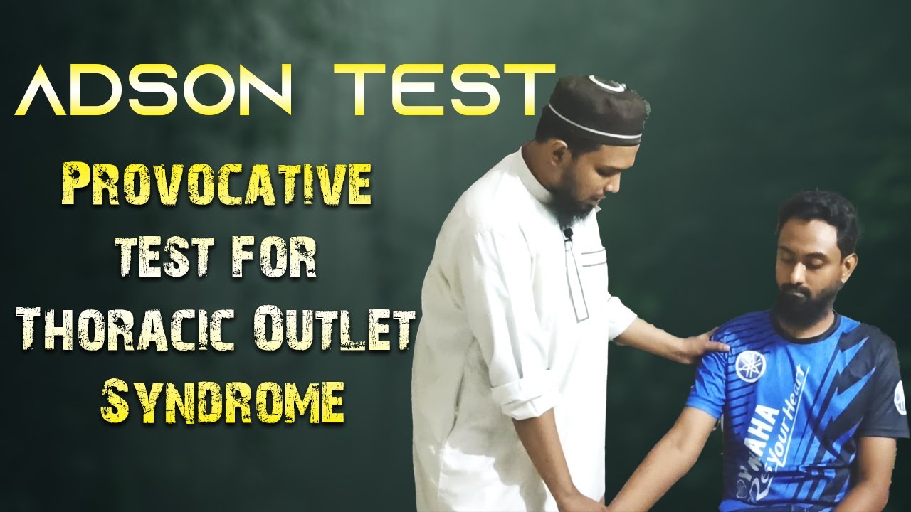 Adson test: Provocative test for Thoracic Outlet Syndrome (TOO) - YouTube