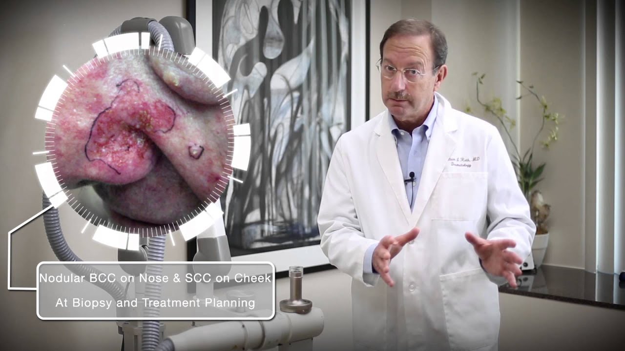 Dr. William I. Roth Presenting Three SRT Cases - YouTube