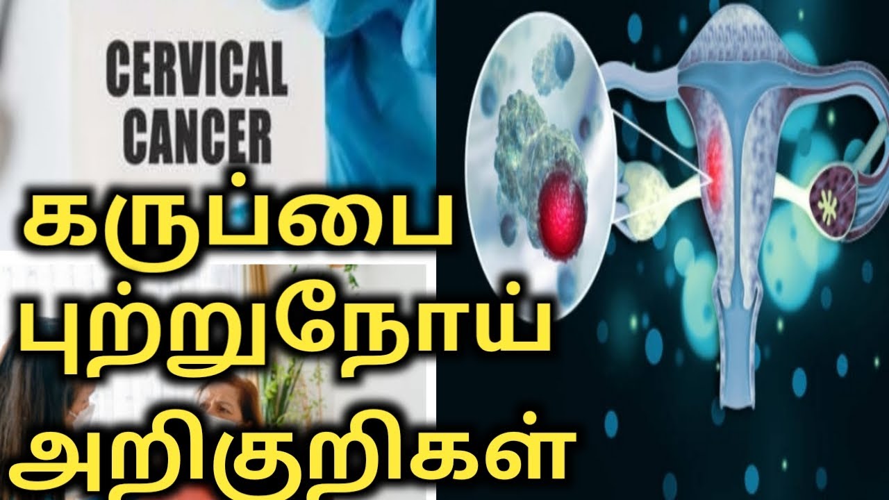 கருப்பை புற்றுநோய் அறிகுறிகள்/karpa pai putrunoi arikurigal/cervical ...