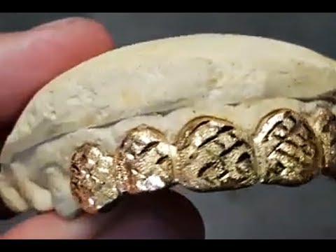 Real Gold Custom Grillz Diamond Cut With Diamond Dust Grills - YouTube