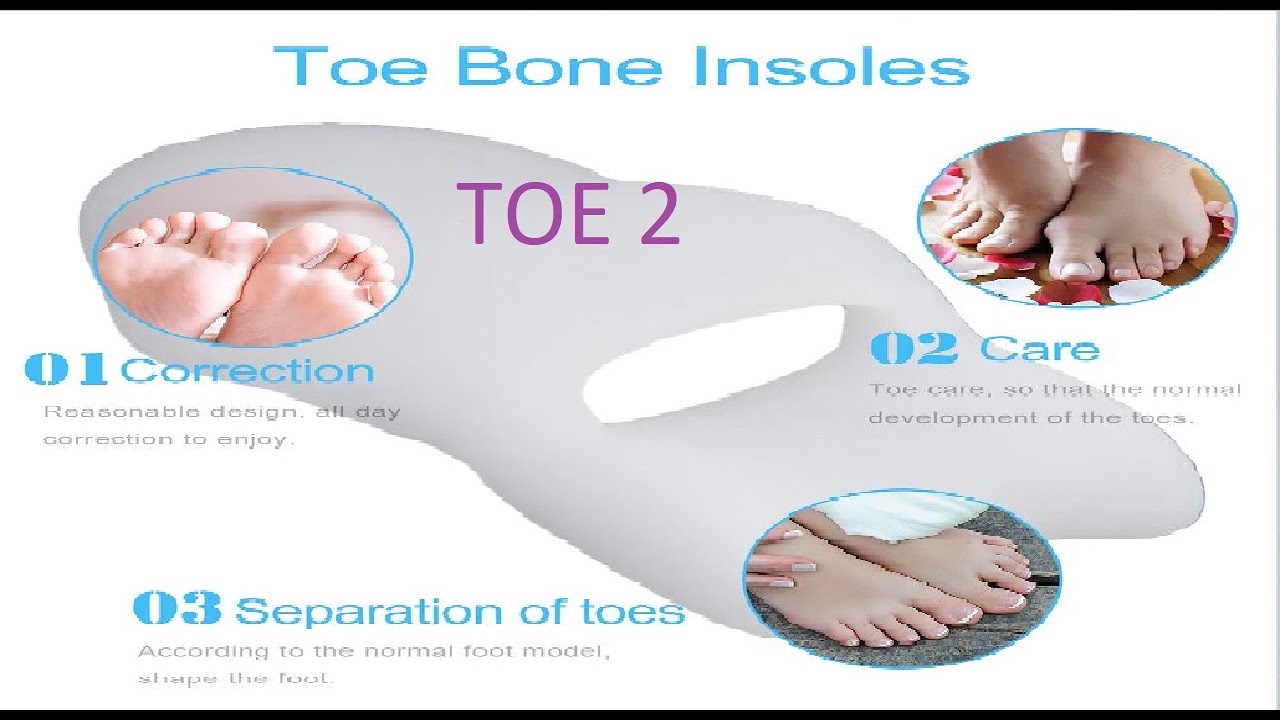 TOE 2 100% LET'S GO OMIGOD........... - YouTube