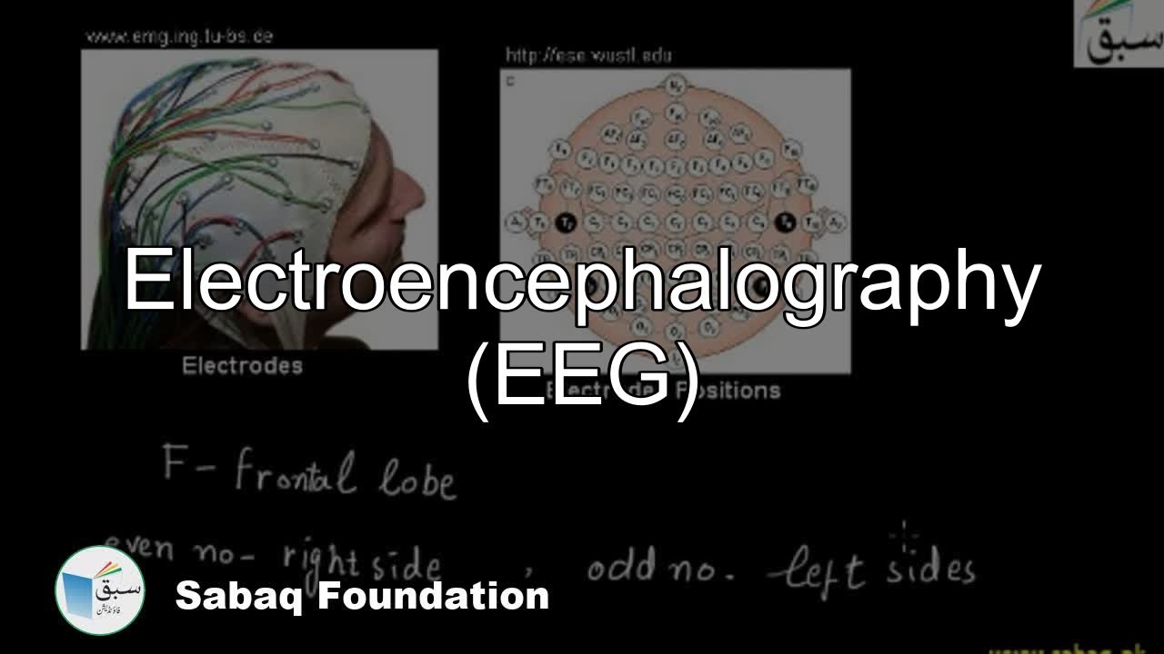 Magnetic Resonance Imaging (MRI), General Science Lecture | Sabaq.pk ...