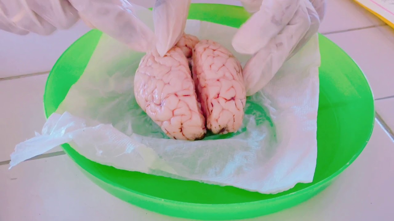 Meningitis- dissection of goat brain - YouTube