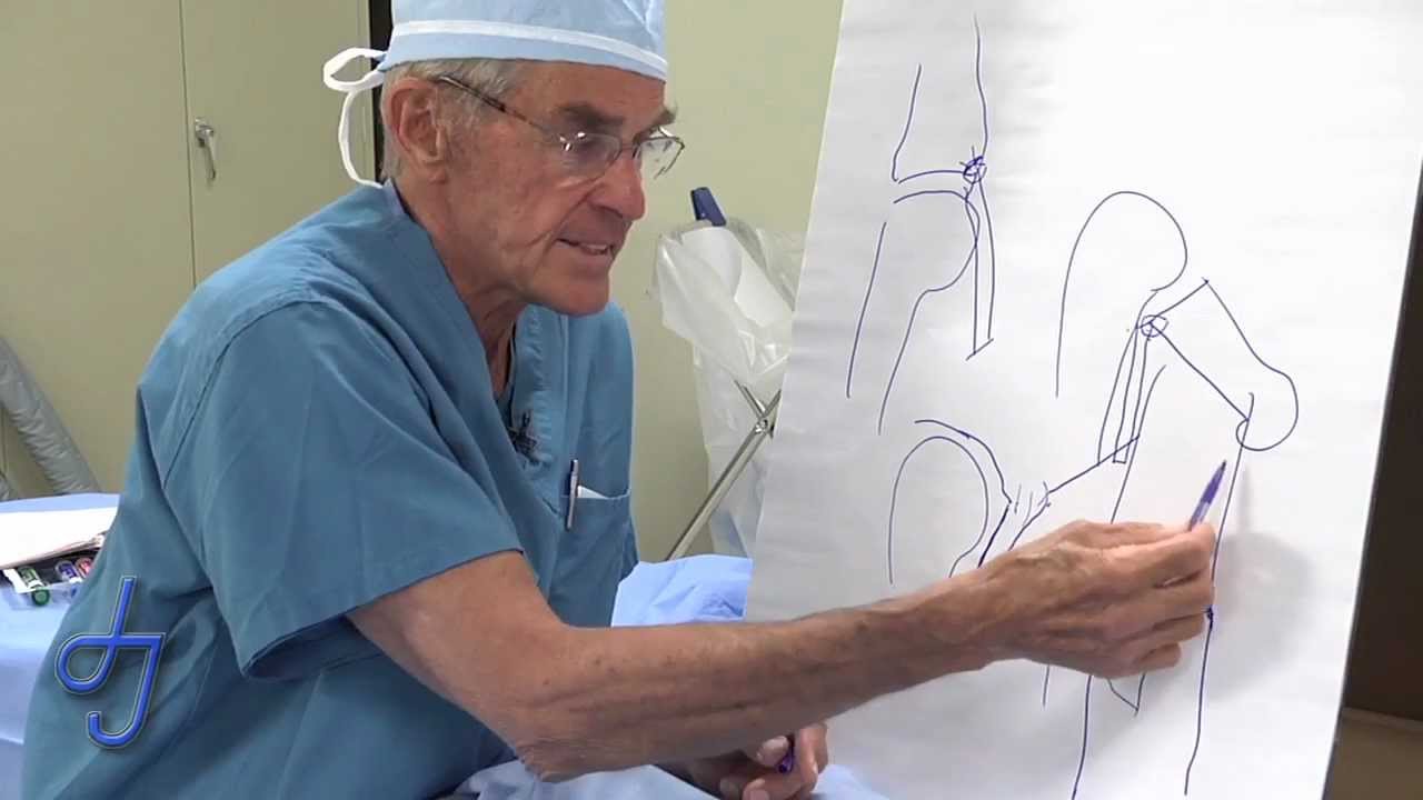 Volar Plate Avulsion - YouTube