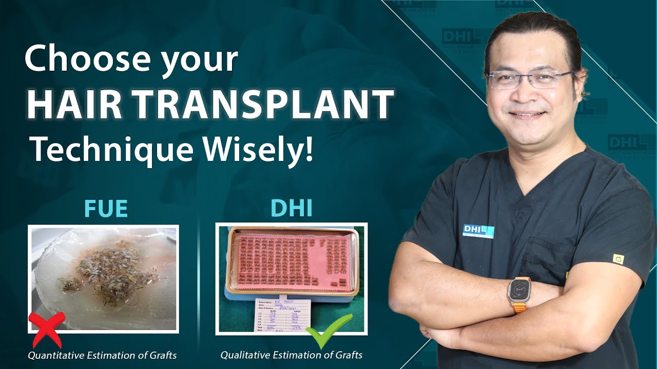 Choose your Hair Transplant technique wisely! DHI India - YouTube