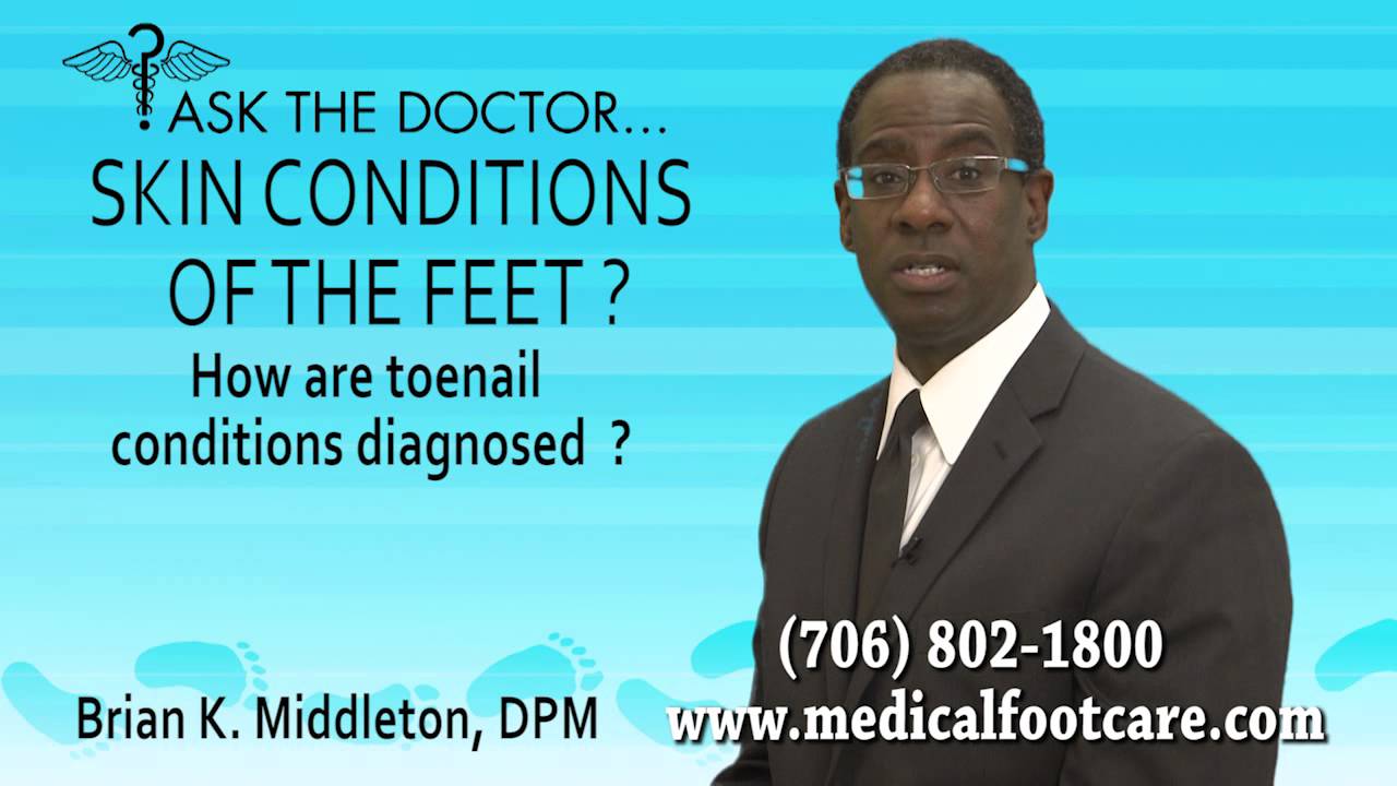 How Are Toenail Conditions Diagnosed? Rome, GA - Podiatrist Brian ...