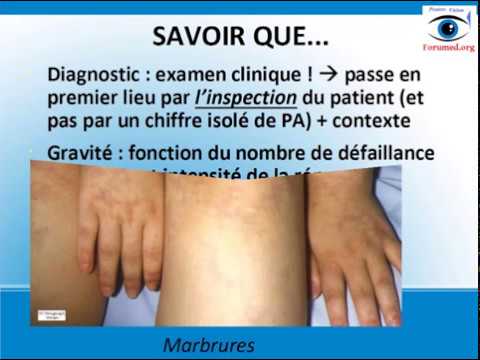 Les États de Choc Cours de Cardiologie - YouTube