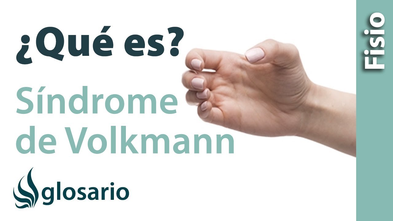 SÍNDROME DE VOLKMANN | ¿Qué es? - YouTube