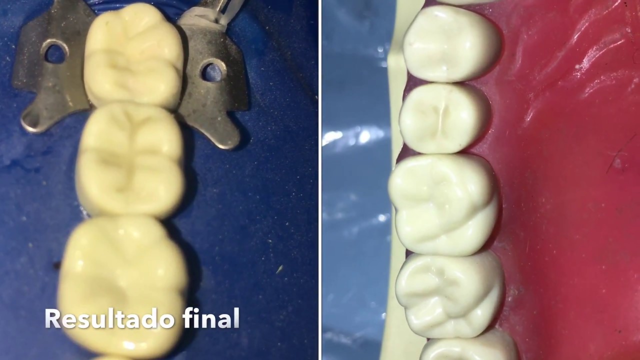 Pasos para realizar una resina fluida - YouTube