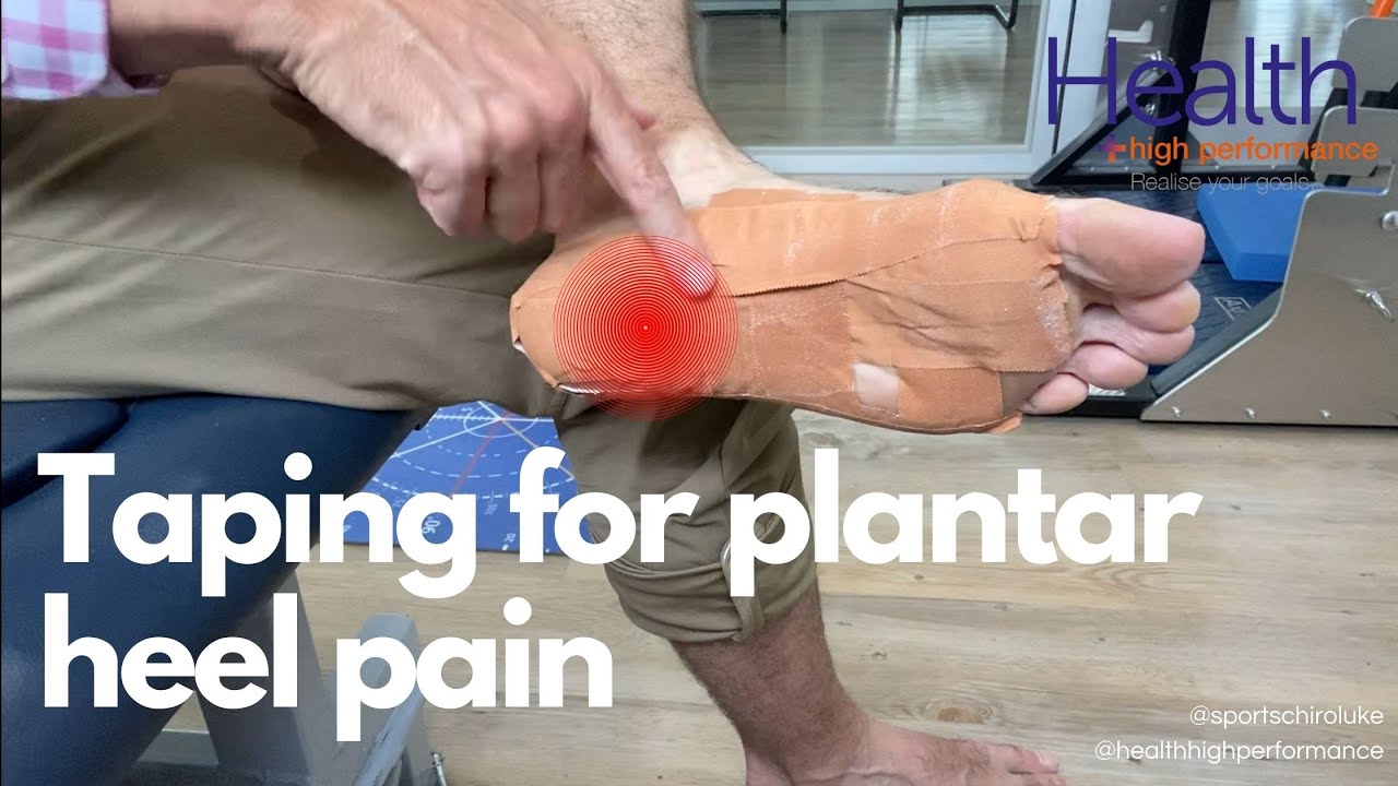 Taping for plantar heel pain & plantar fasciitis | Sports Chiropractor ...