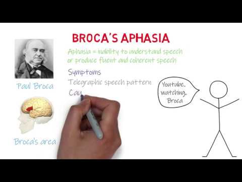 Broca's Aphasia (Expressive Aphasia) - YouTube