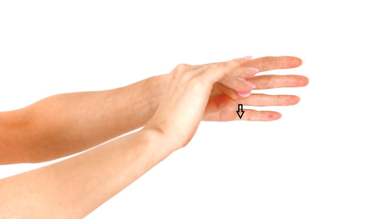 Passive Thumb Flexion MCP - YouTube