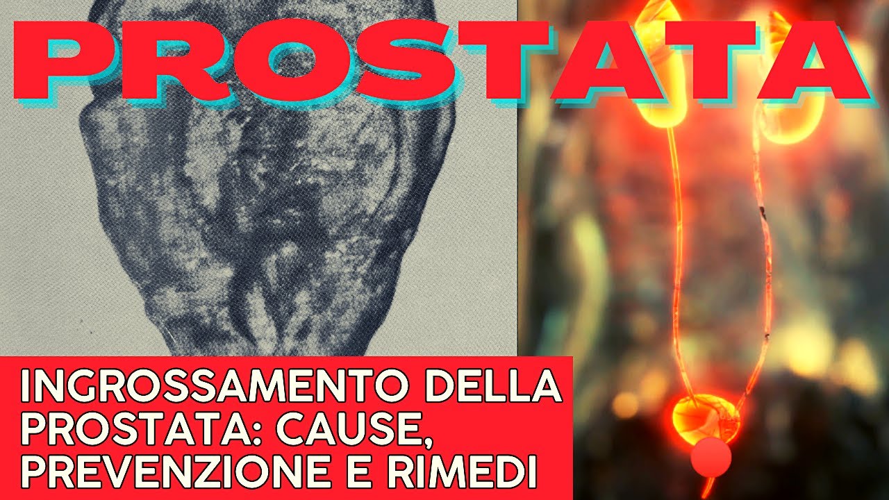 Prostata ingrossata: sintomi, rimedi e prevenzione #saluteelongevità # ...