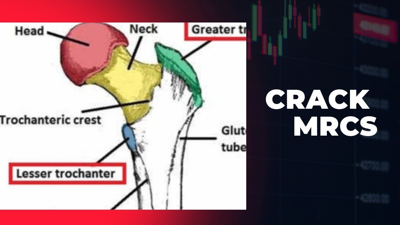 Lesser trochanter of femur MRCS question solve - YouTube