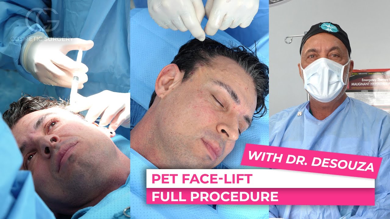 PET: Face Lift in men! Full procedure / CG Cosmetic Surgery - YouTube