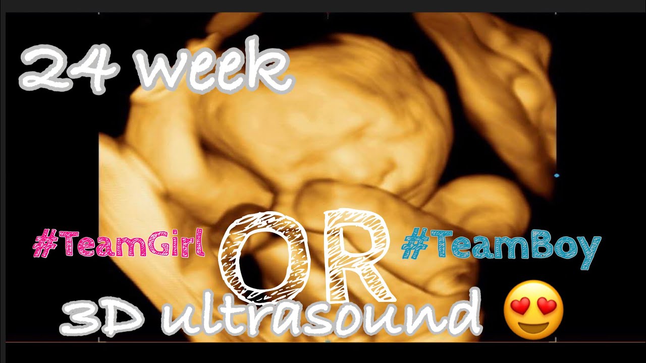 3D ULTRASOUND @ 24 WEEKS! - YouTube