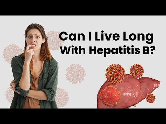 Pictures Of Hepatitis B Patients