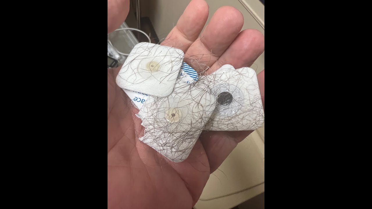 Wherein I get tortured by EKG sticky probe removal - YouTube