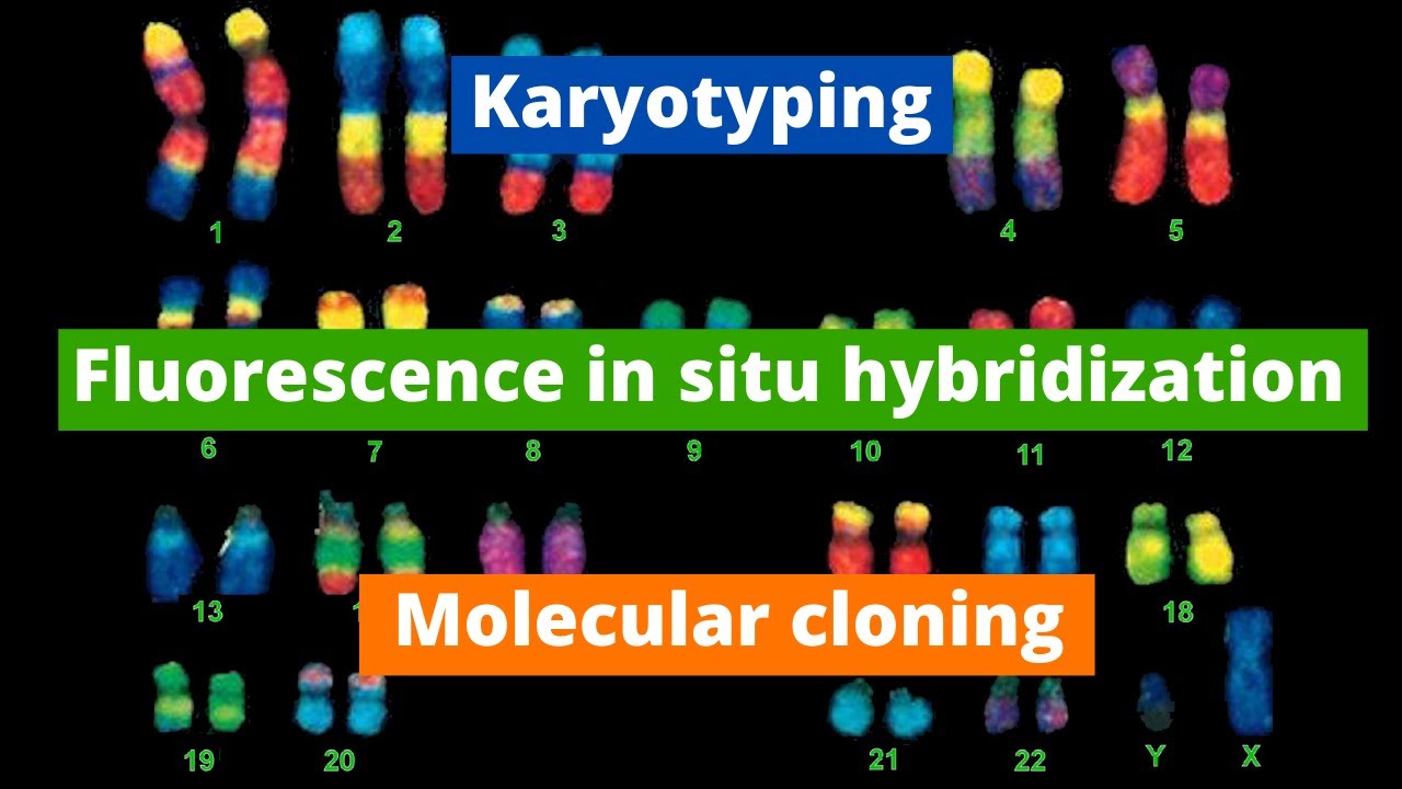 USMLE - Step 1 - Lesson 30 Karyotyping, Fluorescence in situ ...