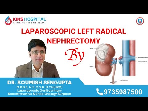Laproscopic Left Radical Nephrectomy | DR. SOUMISH SENGUPTA M.CH ...