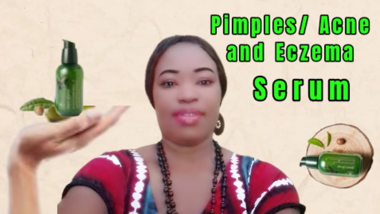 How to make 3 in 1 serum for pimples, acne and eczema (diy) - YouTube