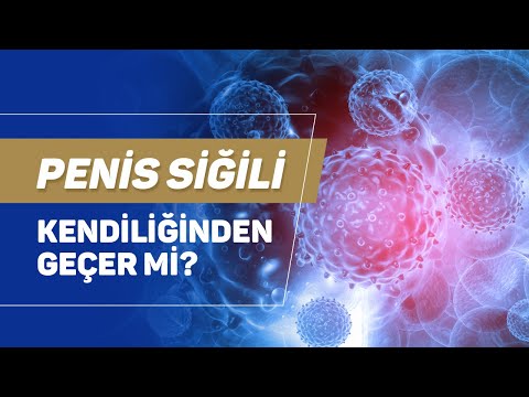 Peniste Siğil Neden Çıkar? Kendiliğinden Geçer Mi? Penis Siğili Tedavi Seçenekleri