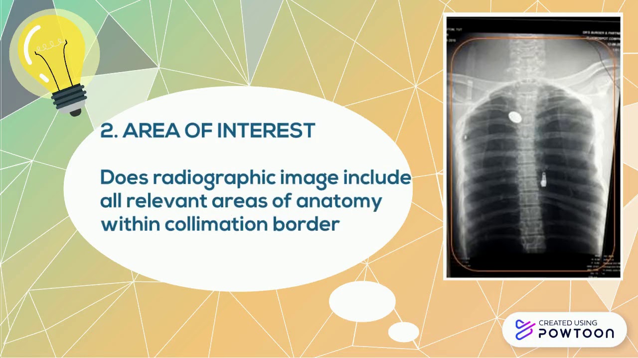 How to do radiographic image critique - YouTube