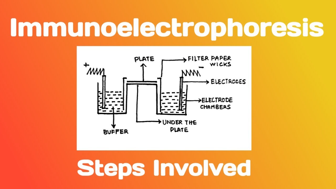 Immunoelectrophoresis:- Introduction and Steps Involved - YouTube