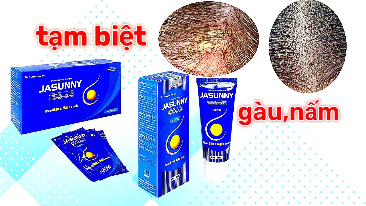 Cách chọn dầu gội TRỊ GÀU dứt điểm, hiệu quả nhanh - YouTube