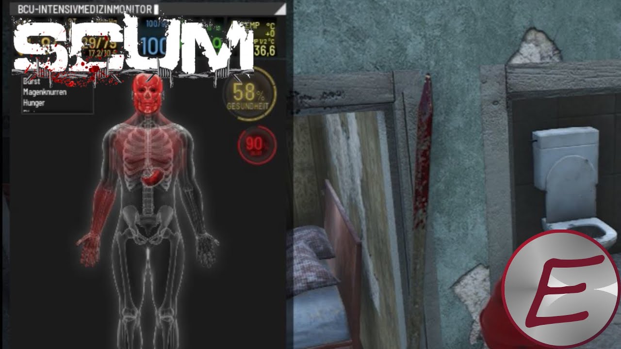 Scum 🩸003 - Nur eine Fleischwunde! - YouTube