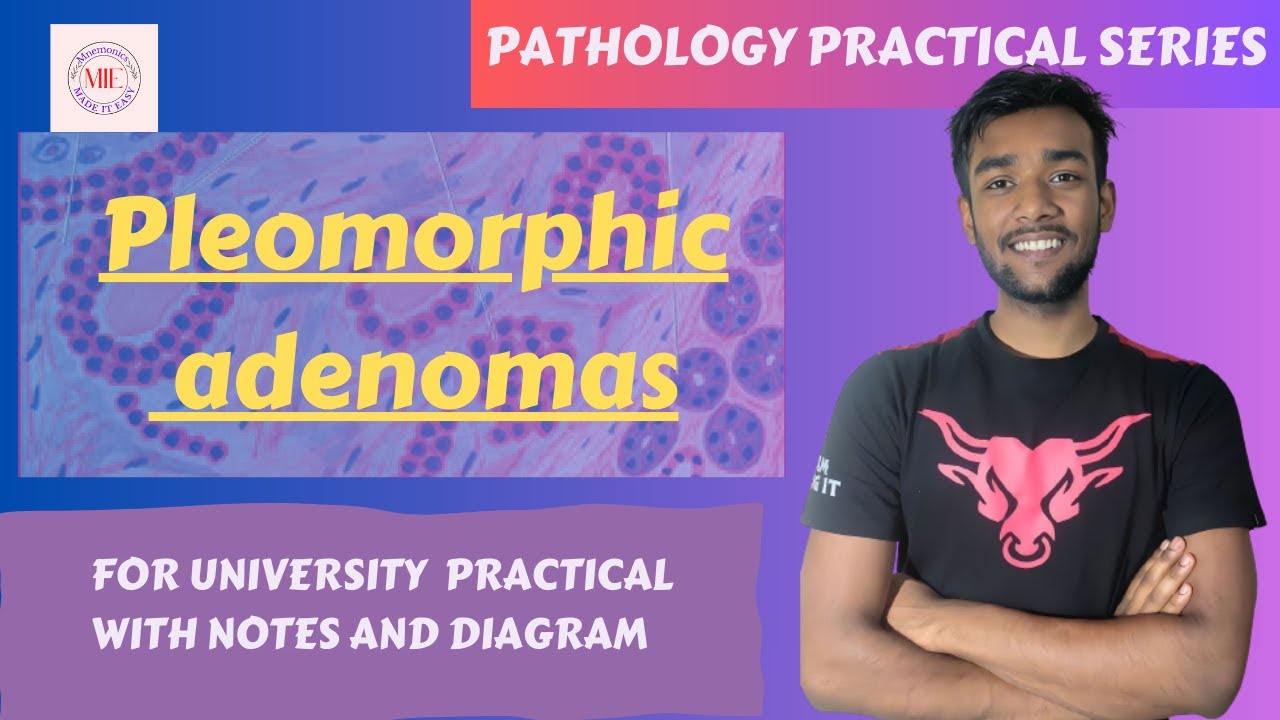 PATHOLOGY PRACTICAL || PLEOMORPHIC ADENOMA with notes and viva ...