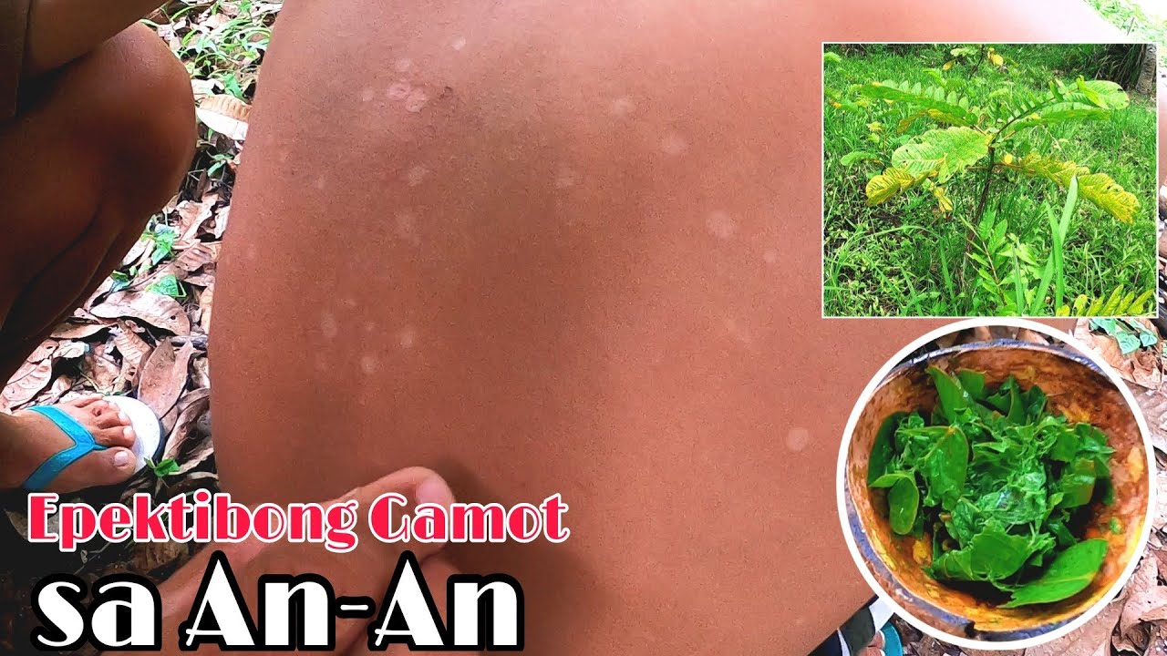 Epektibong Gamot sa An-An | Handcam hunter - YouTube