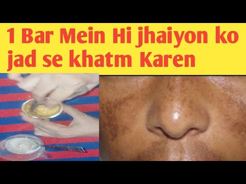 Chehre ke daag dhabbe jhaiyan kaise hataye | Chehre par jhaiyan khatam ...