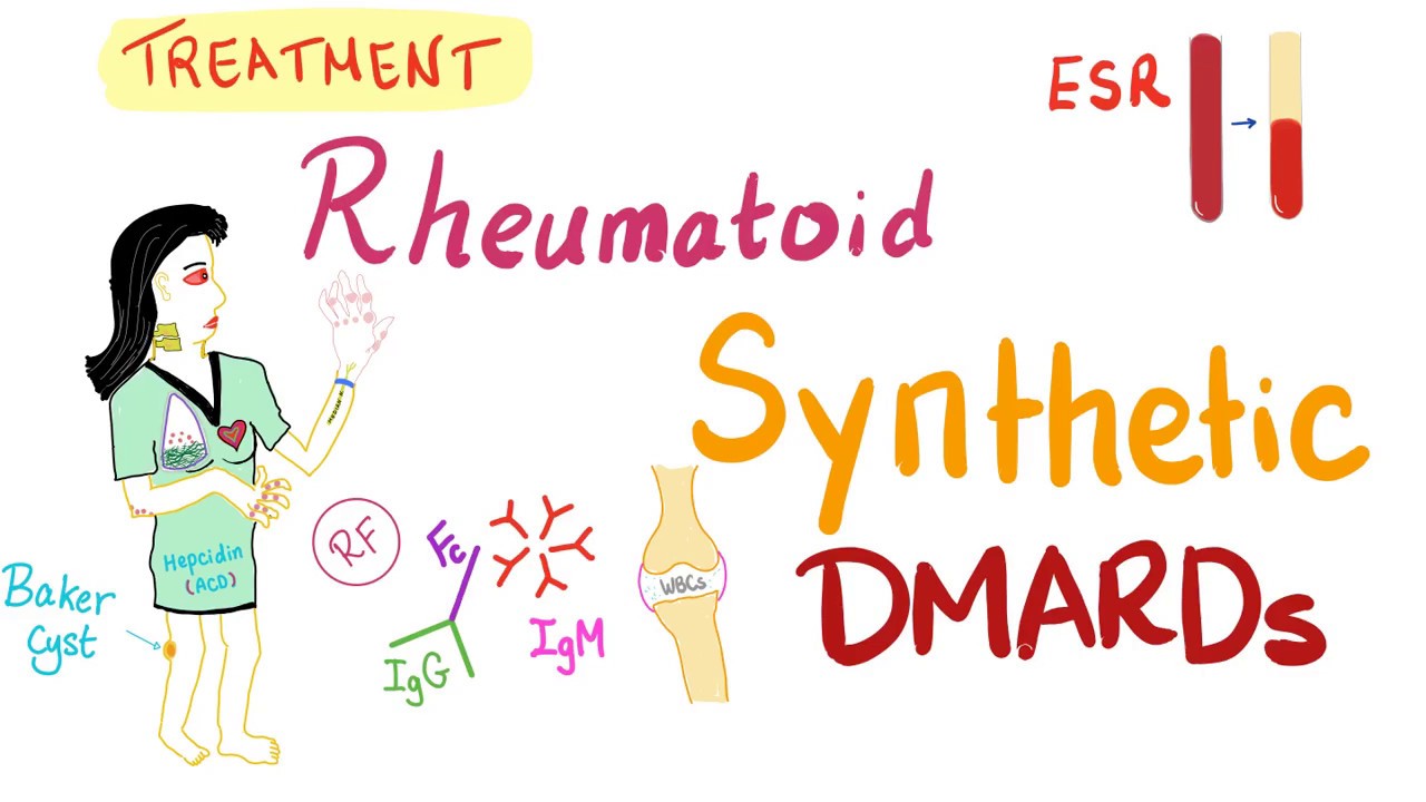 Rheumatoid Arthritis - Management (C) - Hydroxychloroquine, Synthetic ...
