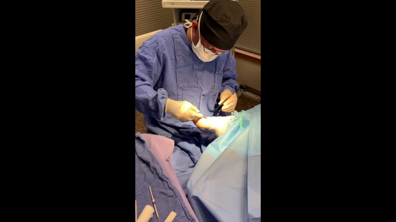 HUGE GANGLION CYST REMOVAL!! - YouTube