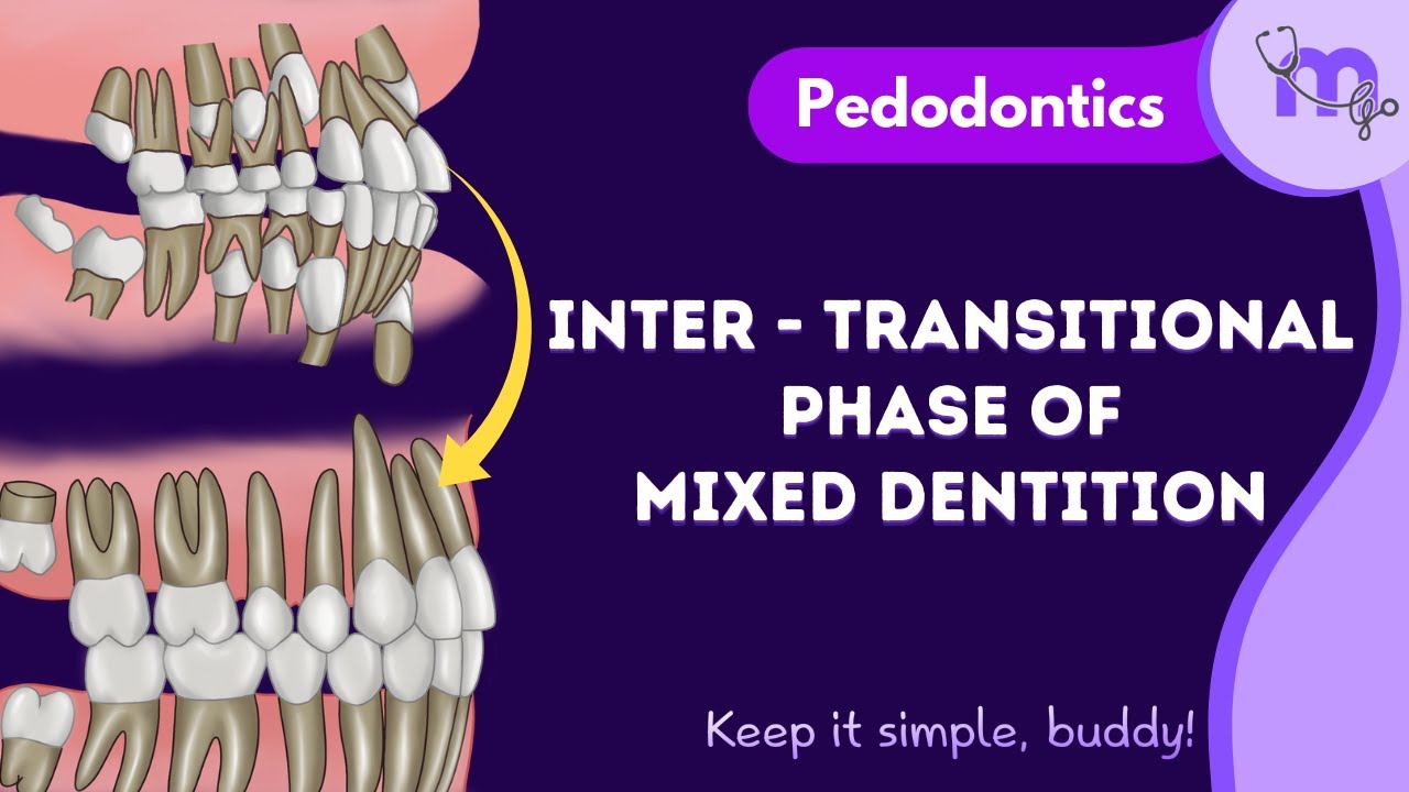 Inter - Transitional Phase of Mixed Dentition | Pedodontics | Animated ...