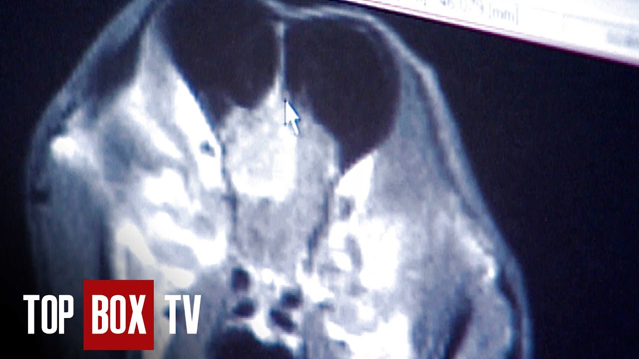 Brain Surgery Performed On Dog - Campus Vets 113 - Bonnie's Brain - YouTube