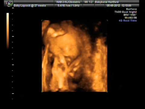 27 week 4d scan - YouTube