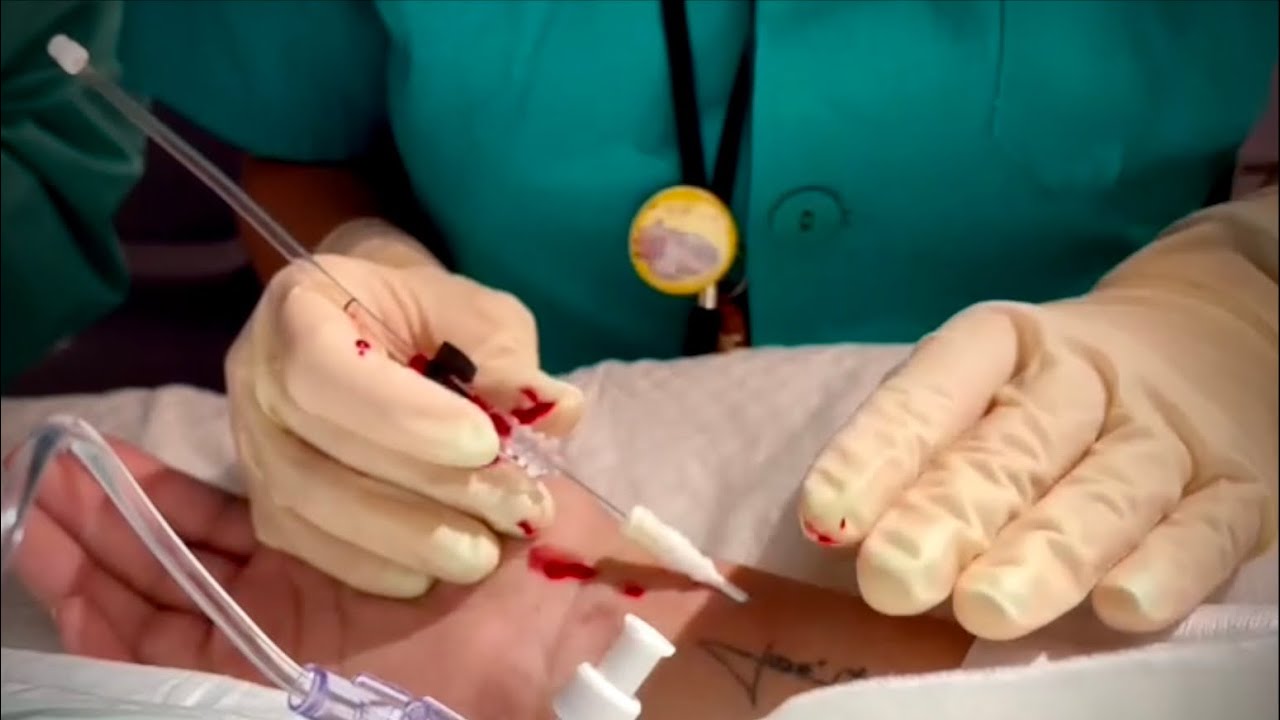 Cómo monitorizar presión arterial invasiva PAI - YouTube